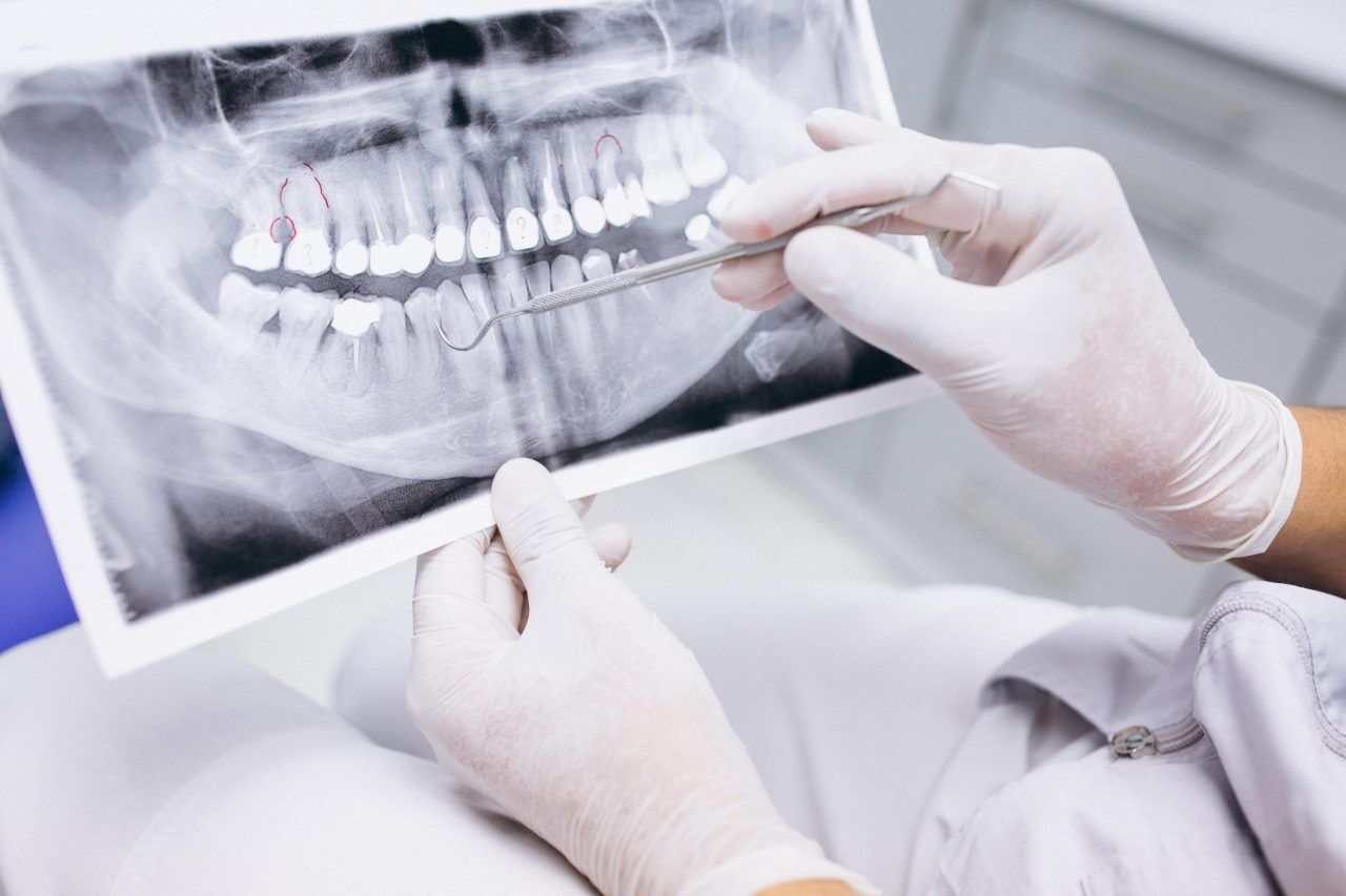 Complete ORE Exam Guide for Dental Success